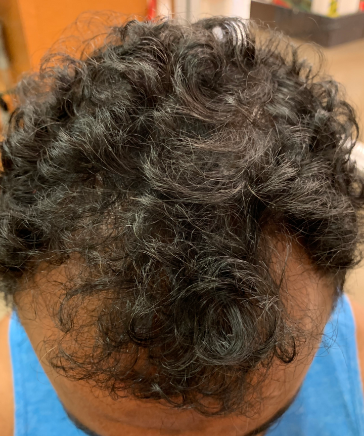 Before and Afters – Actiiv Hair Science